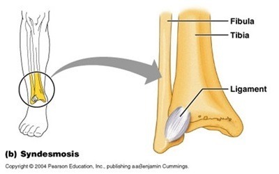 KLASIFIKASI SENDI DI TUBUH (BAGIAN 2) – SINARTROSIS & AMFIARTROSIS ...